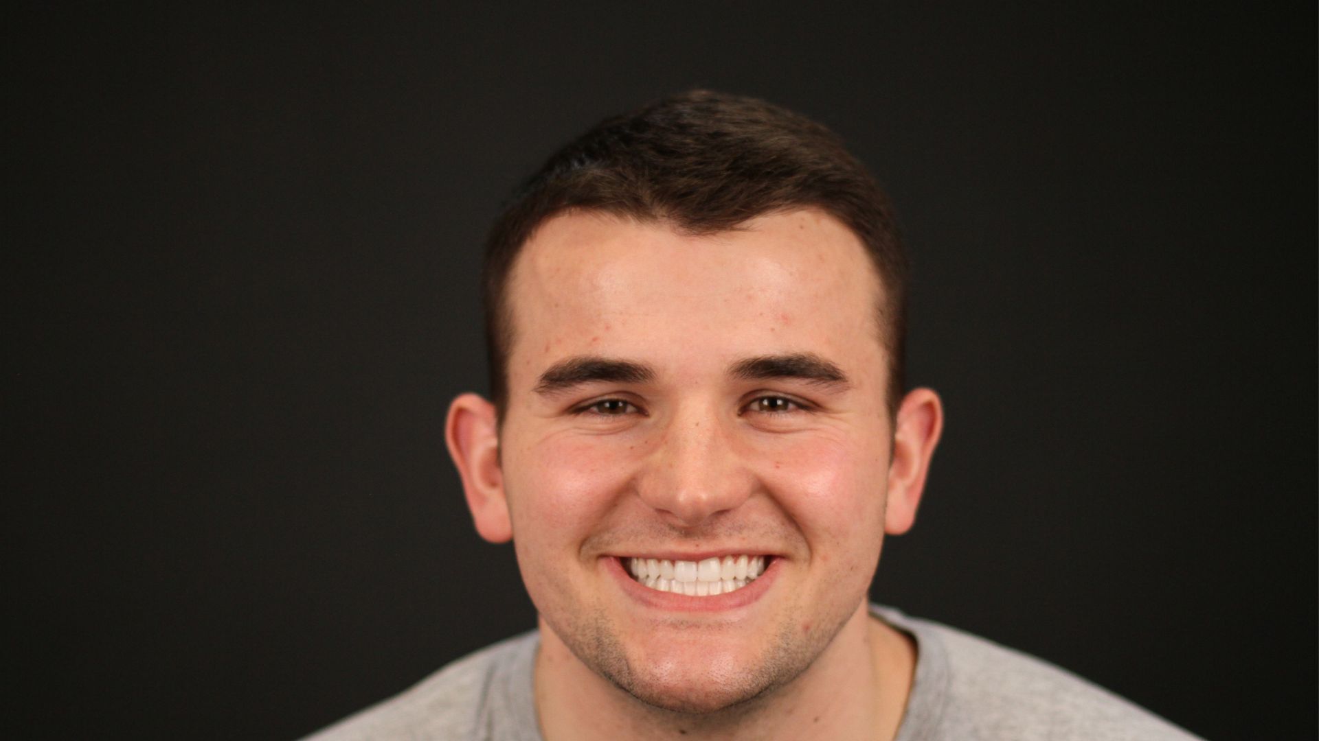 Luke and his peg tooth - Smile Stories