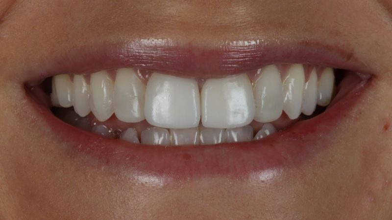 Private Dentist Bournemouth | Winton | Smile Stories