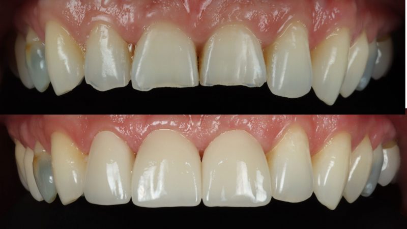 Private Dentist Bournemouth | Winton | Smile Stories