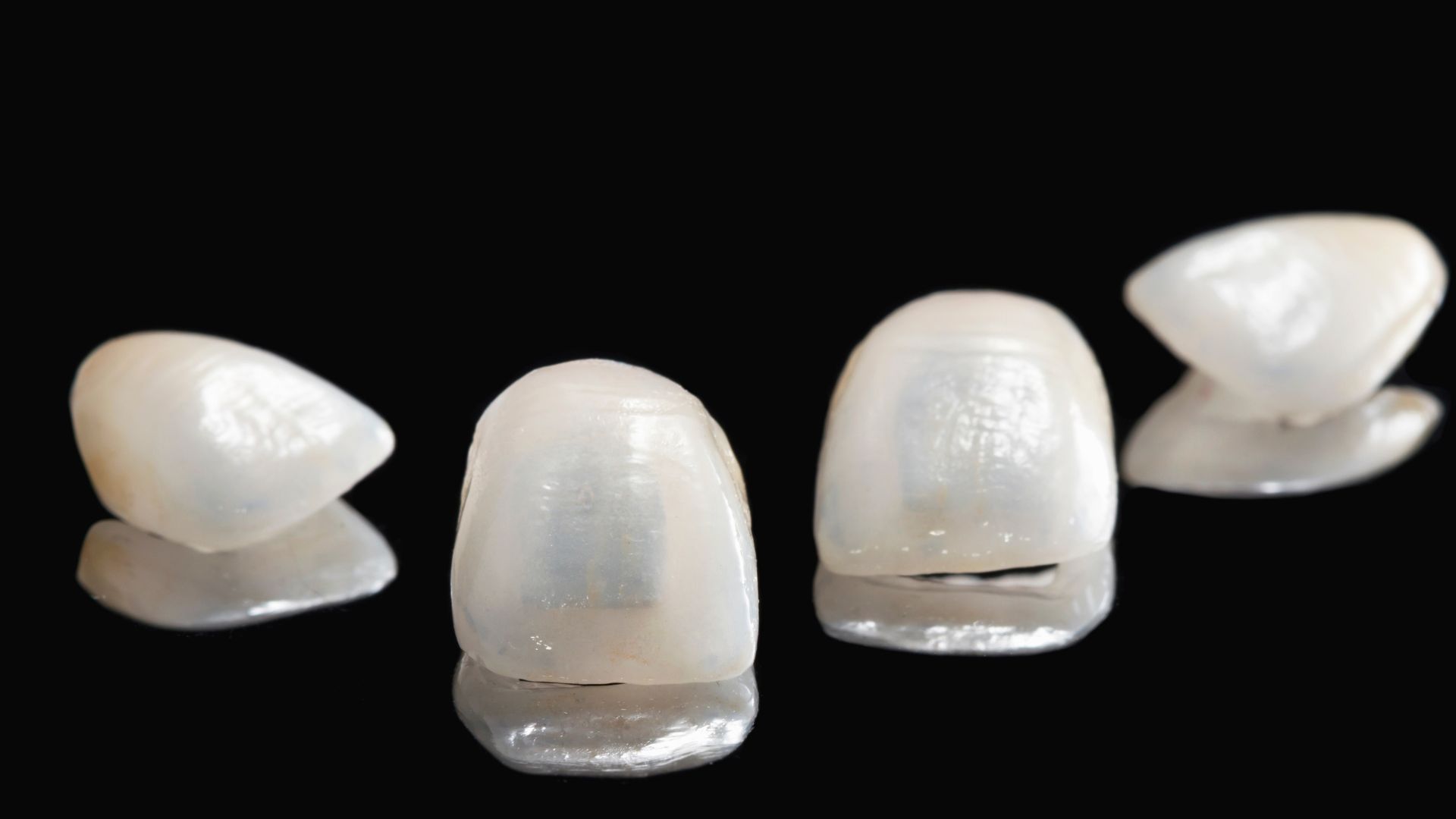 composite-veneers-or-porcelain-which-is-best